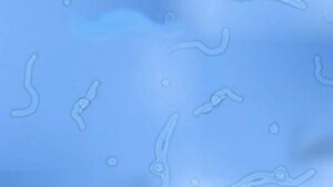 ¿QUÉ SON LAS MIODESOPSIAS? - IOV